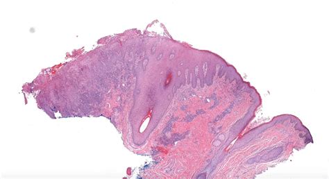Jerad Gardner MD On Twitter RT JMGardnerMD 30 Yo Woman With
