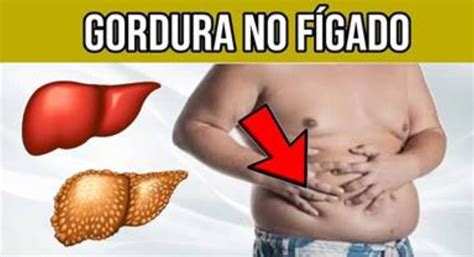 Gordura No F Gado O Que Causa A Esteatose Hep Tica Brasil Acontece