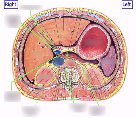 Abdominal Cross Section T12 Diagram Quizlet