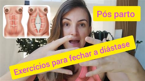 Pós parto MELHORES EXERCÍCIOS PARA DIÁSTASE Treino completo YouTube