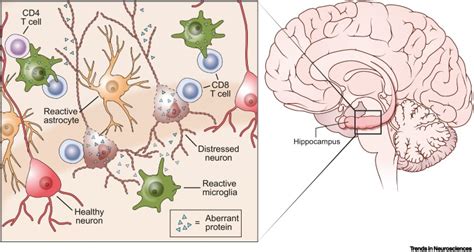 How The Immune System Shapes Neurodegenerative Diseases Trends In