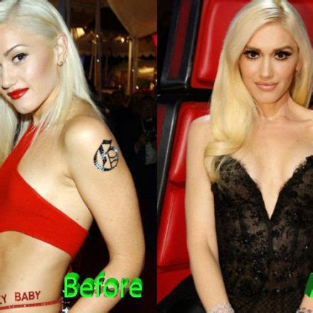Gwen Stefani Plastic Surgery Then And Now