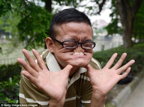 Photos Man Wins N1 6m For Worlds Ugliest Face Gistmania
