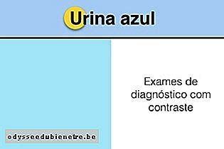 8 Malattie Che Possono Cambiare Il Colore Delle Urine It
