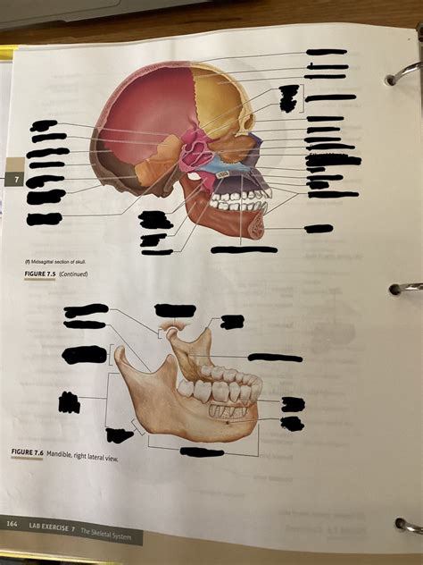 Midsagittal Skull Diagram Quizlet