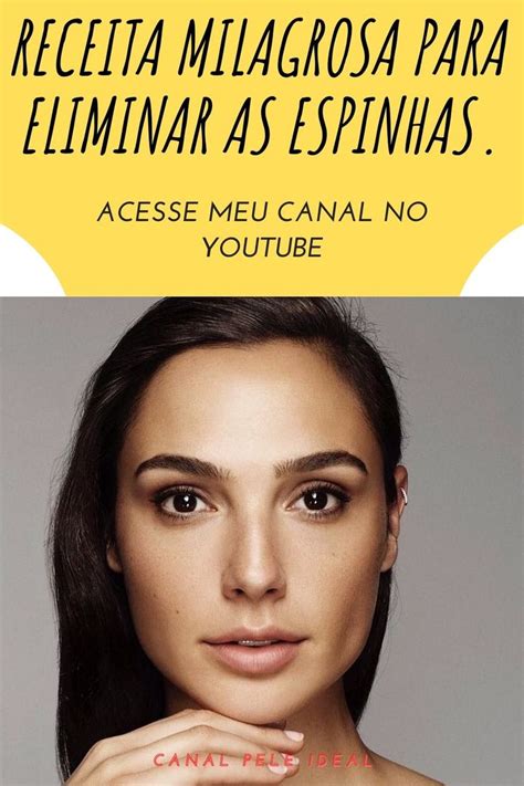 Receita Milagrosa Para Eliminar As Espinhas Do Seu Rosto De Uma Maneira