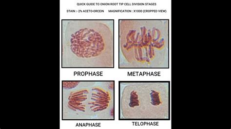 Quick Guide To Onion Root Tip Cell Division Stages Prophase Metaphase