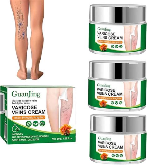 Varicose Veins Cream 50g Krampfadern Creme Gegen Besenreiser Creme