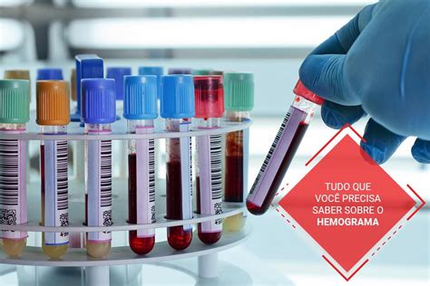 Tudo que você precisa saber sobre o Exame Hemograma Labormac