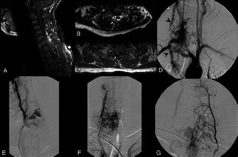 Case 2 Sagittal Postcontrast Fat Saturated T1 Weighted Images