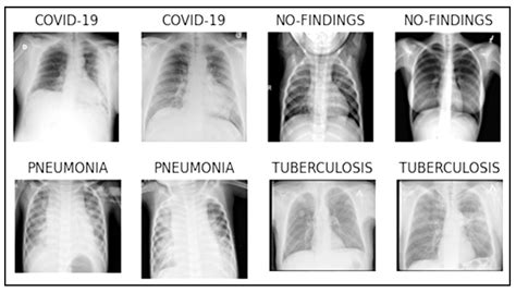Diagnostics Free Full Text Joint Diagnosis Of Pneumonia Covid