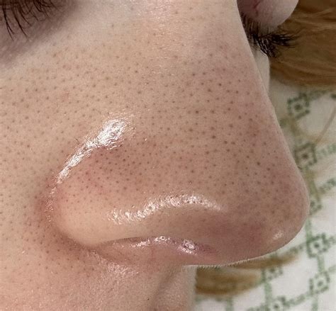 Best R Skincare Addiction Images On Pholder I Took Back My Skin