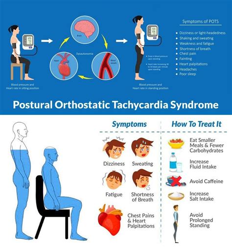 Navigating Postural Orthostatic Tachycardia Syndrome El Paso S