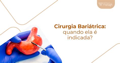 Cirurgia Bari Trica Quando Ela Indicada Dr Wilson De Freitas Jr