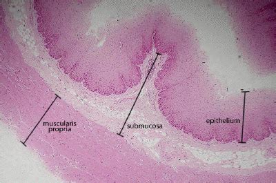 Stratified Squamous Epithelium Non Keratinized Esophagus