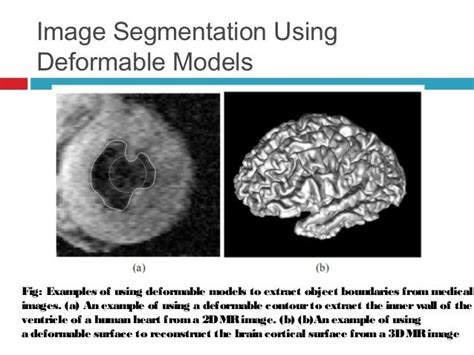presentation on deformable model for medical image segmentation