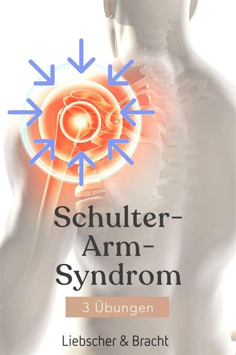 Schulter Arm Syndrom Ursachen Verstehen Schmerzen Loswerden Video