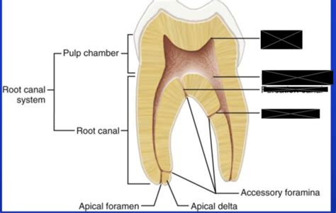 Root Canal Anatomy Flashcards Quizlet