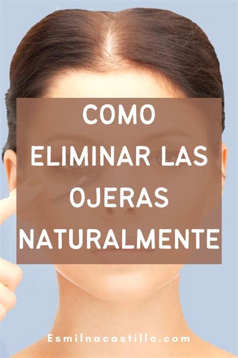 Tenías en cuenta que adjuntado con la hidratación y la custodia del
