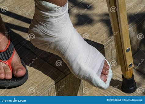 Man With Broken Leg In White Plaster Cast Go Down Steps With Crutches
