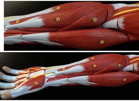 Anterior Arm Diagram Quizlet