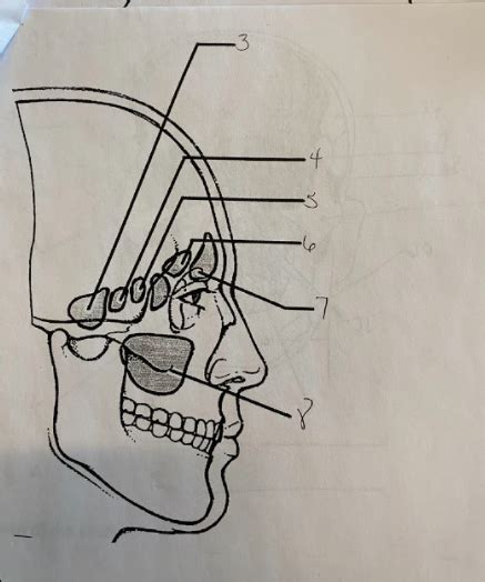 Sinuses Diagram Quizlet