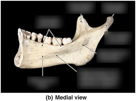 Mandible Diagram Quizlet