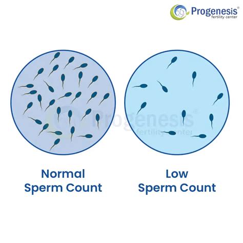 What Causes Low Sperm Count And How Is It Treated