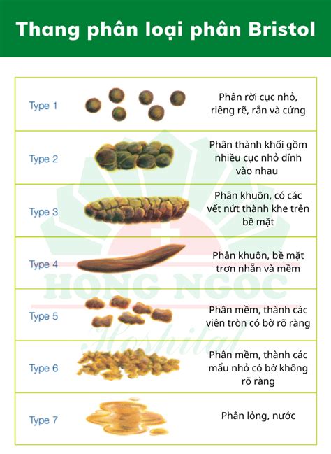 Hình ảnh phân trẻ sơ sinh như thế nào là táo bón ở trẻ sơ sinh