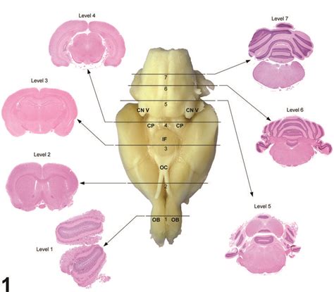 Image Of Seven Transverse Coronal Sections In The Brain From A Rat