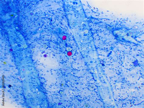 Foto De Cryptosporidium Parvum Protozoa Positive Red Sphere Shape In