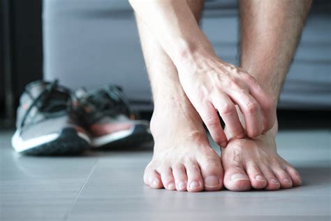 Athletes Foot Types Symptoms Causes And Treatments ActiveBeat