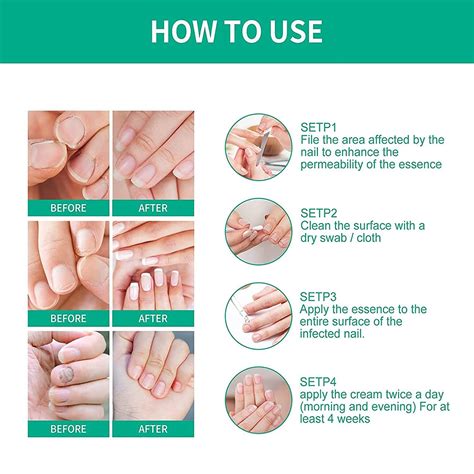 Ouhoe Kerassentials Nail Fungus Repair Liquid 1 Oz Fast Acting Formula