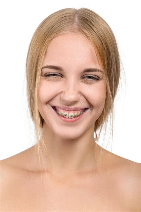 Girl With Braces Stock Photo Image Of Looking Girls 64372834