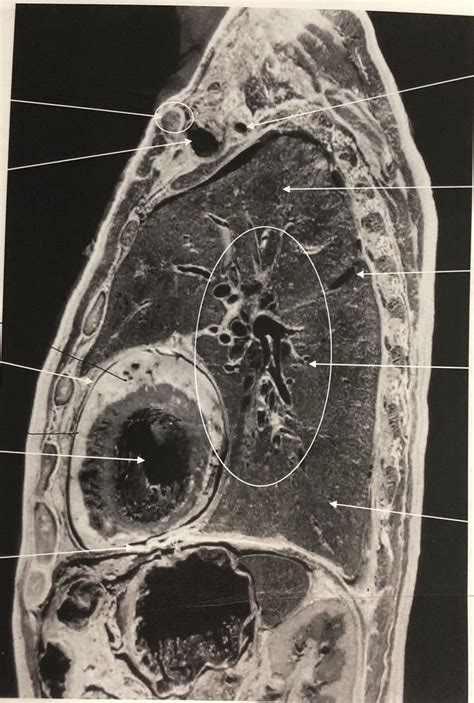 Thorax Image Diagram Quizlet