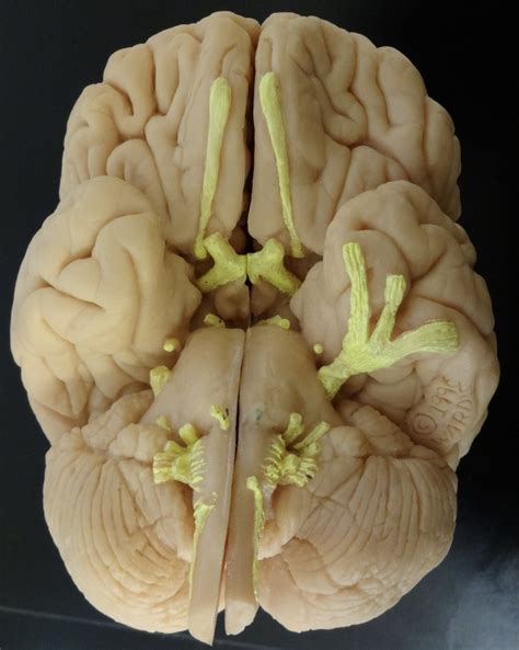Fig 17 3 Ventral Aspects Of Human Brain Diagram Quizlet