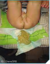 3RB Réseau Ressource Risque Biologique