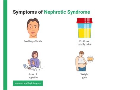 Nephrotic Syndrome Causes Symptoms And Treatment Options