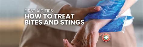 First Aid Tips How To Treat Bites And Stings The First Aid Kits