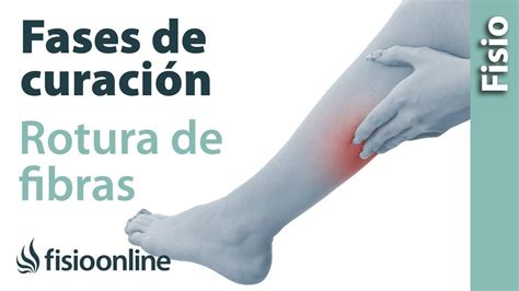 Rotura de fibras o desgarro muscular Proceso y fases de curación
