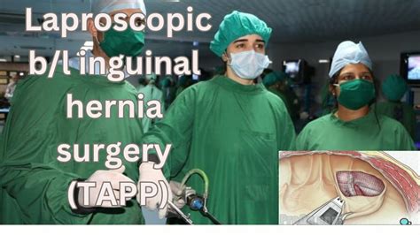 Laproscopic B L Inguinal Hernia Repair TAPP Approach With Anatomical