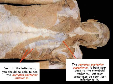 Serratus Posterior Superior Cadaver
