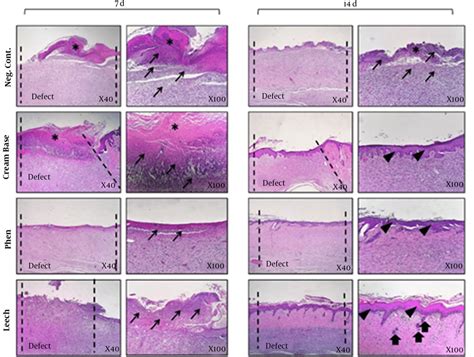 Histopathological Analysis H E Stained Microscopic Sections Of Skin