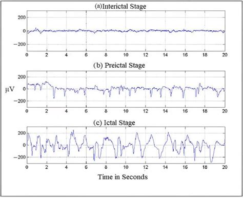 diagnostics free full text deep eeg an optimized and robust framework and method for eeg