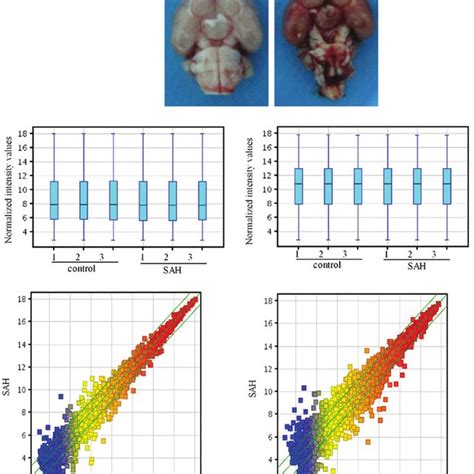 Differential Expression Profiles Of The LncRNAs And MRNAs Between The