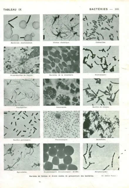 CABINET DE CURIOSITÉ planche anatomie humaine Variétés bactéries issue