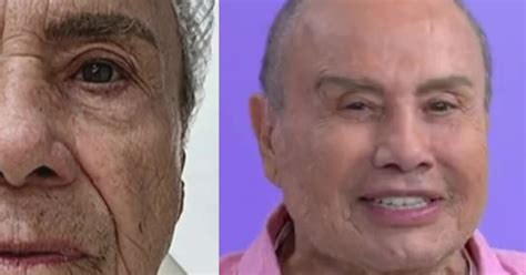 Harmonização facial de Stênio Garcia aos 91 anos ator manda a real