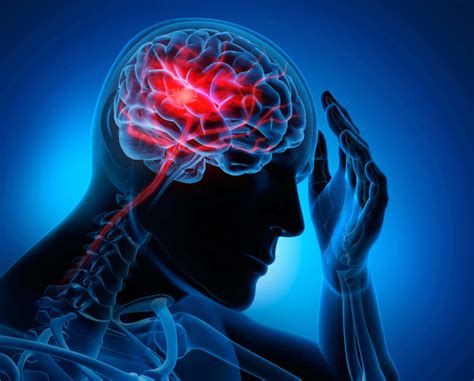 Síntomas secuelas y rehabilitación tras un accidente cerebrovascular