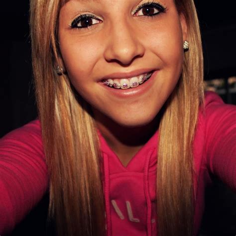 Orthodontics Teen Selfie Nude SexiezPicz Web Porn