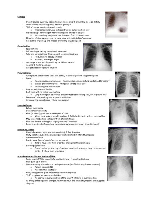 Chest X Ray With Pathologies Collapse Usually Caused By Airway